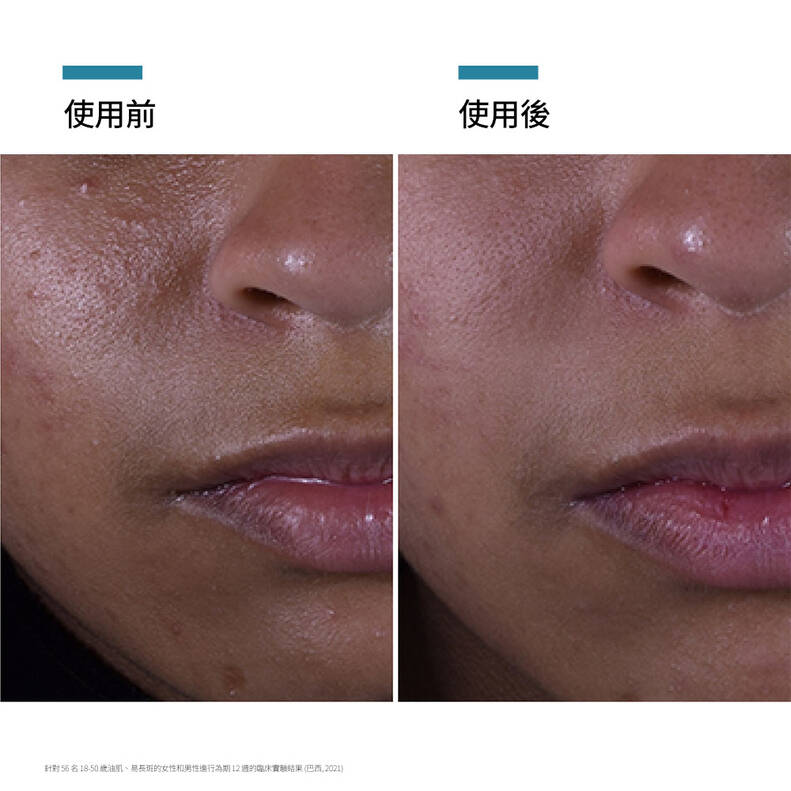 SCF淨化調理抗老精華(30ml) | 油痘肌維C | 修麗可